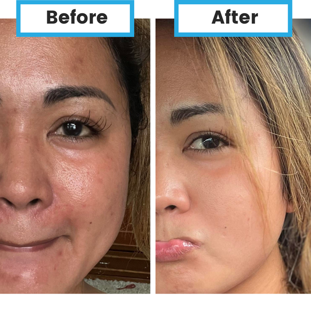 Neumi - A New You Starts with Neumi