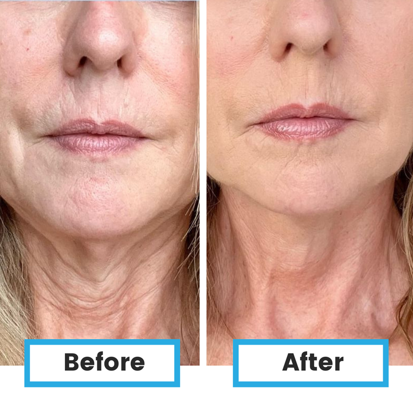 Neumi - A New You Starts with Neumi